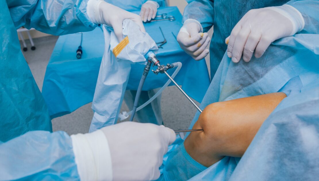 Total Knee Replacement