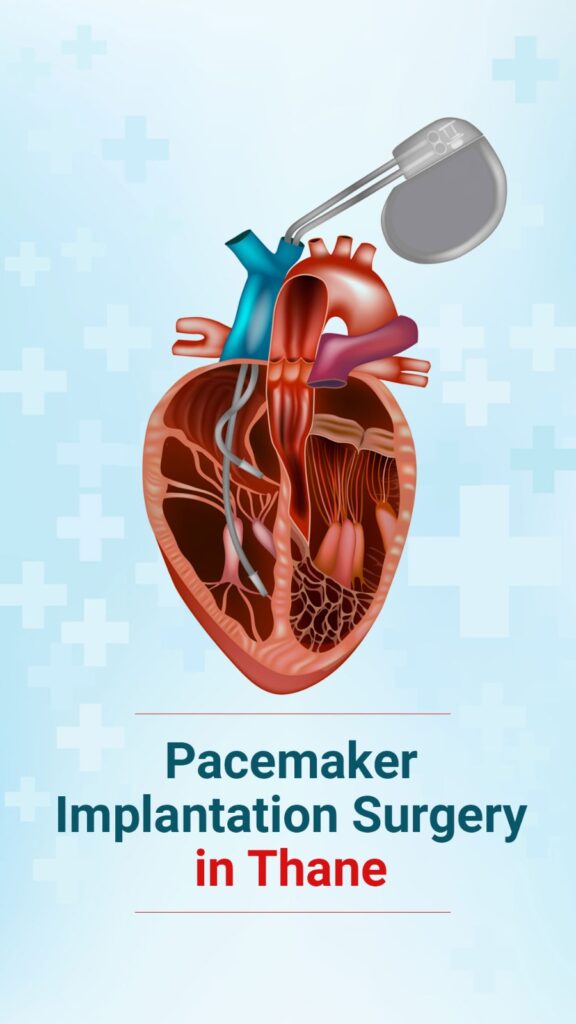Pacemaker Surgery in Thane at Jinkushal Hospital - Cost, Procedure, and ...