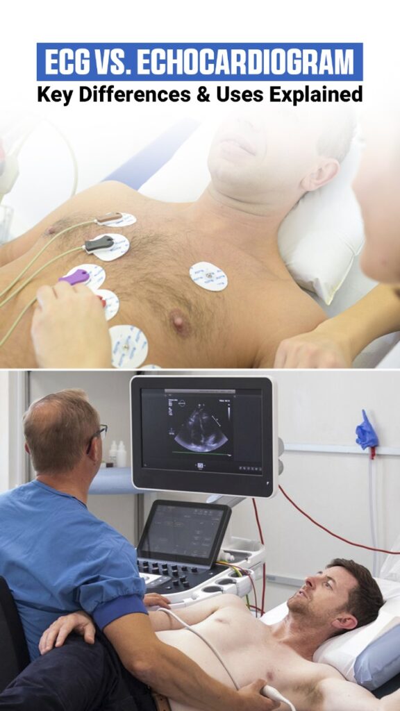 ECG vs. Echocardiogram: Key Differences and Uses Explained